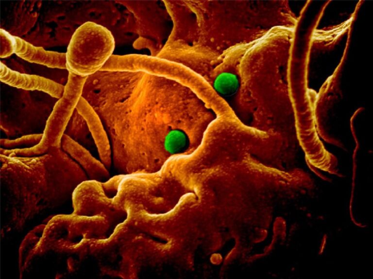 Virus del camello: qué es y cómo se contagia – La Razón